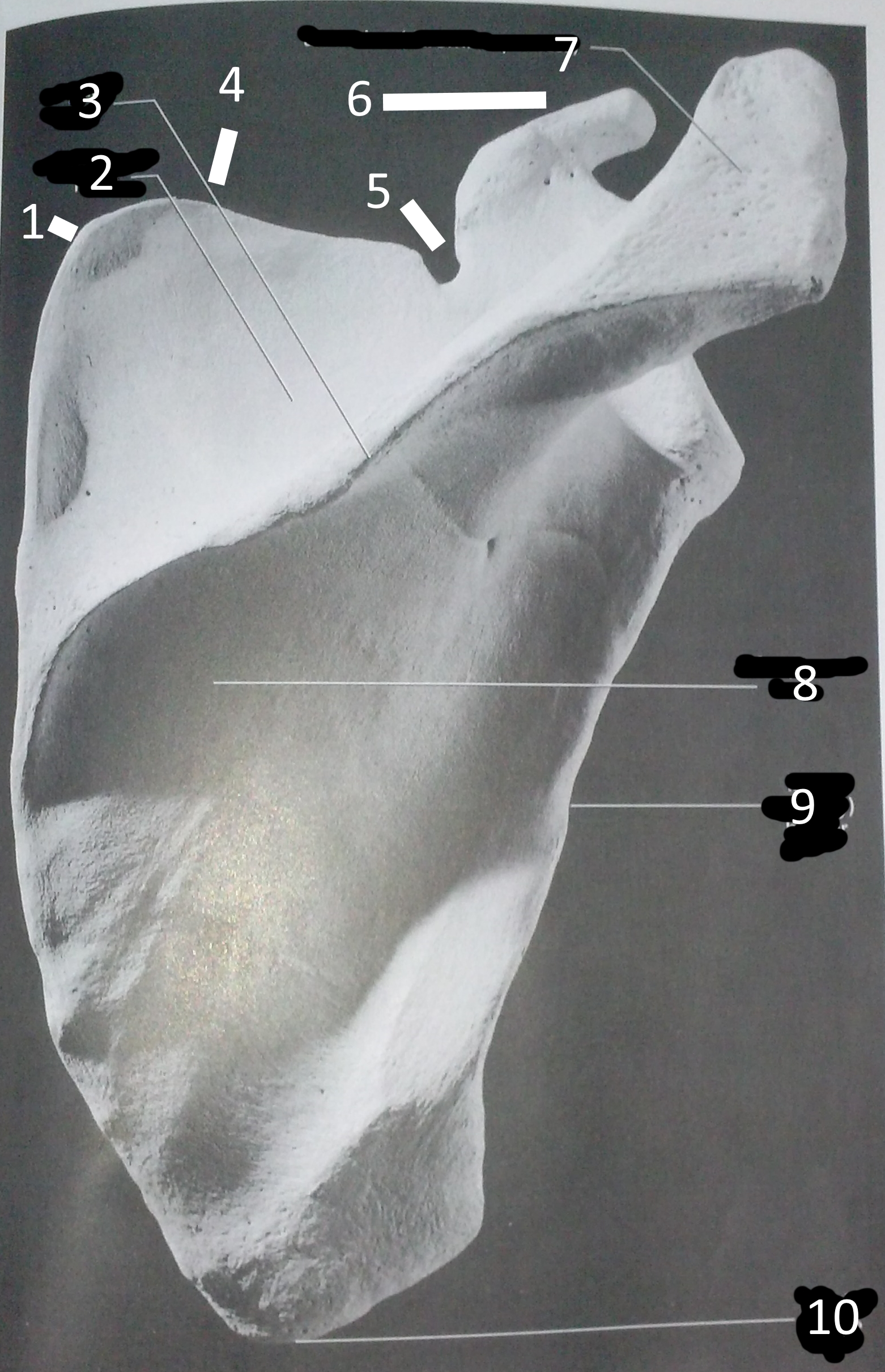 Scapula Labeling - ProProfs Quiz