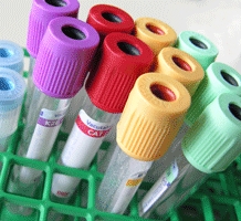 Phlebotomy Tubes Quiz Questions - ProProfs Quiz