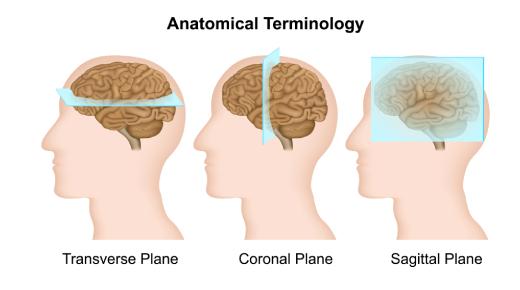 An Anatomical Terminology Quiz ProProfs Quiz